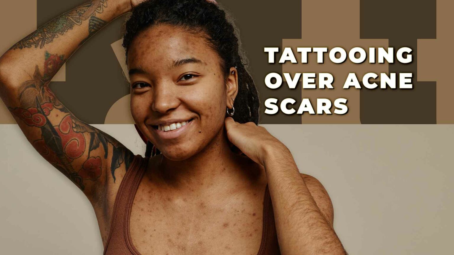 Tattoos and Acne: What You Need to Know Before Getting Inked