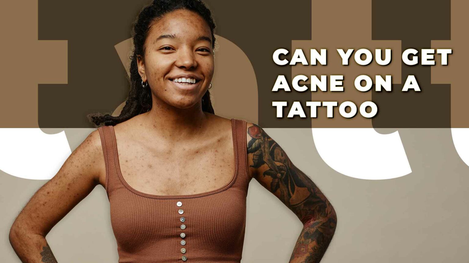 Tattoos and Acne: What You Need to Know Before Getting Inked