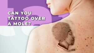 Tattooing Over Or Around Moles?